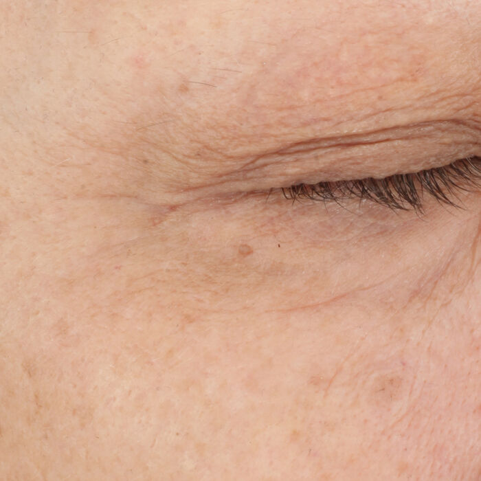 A-Shaba Complex™ Eye Serum | Anti-Aging Eye Cream